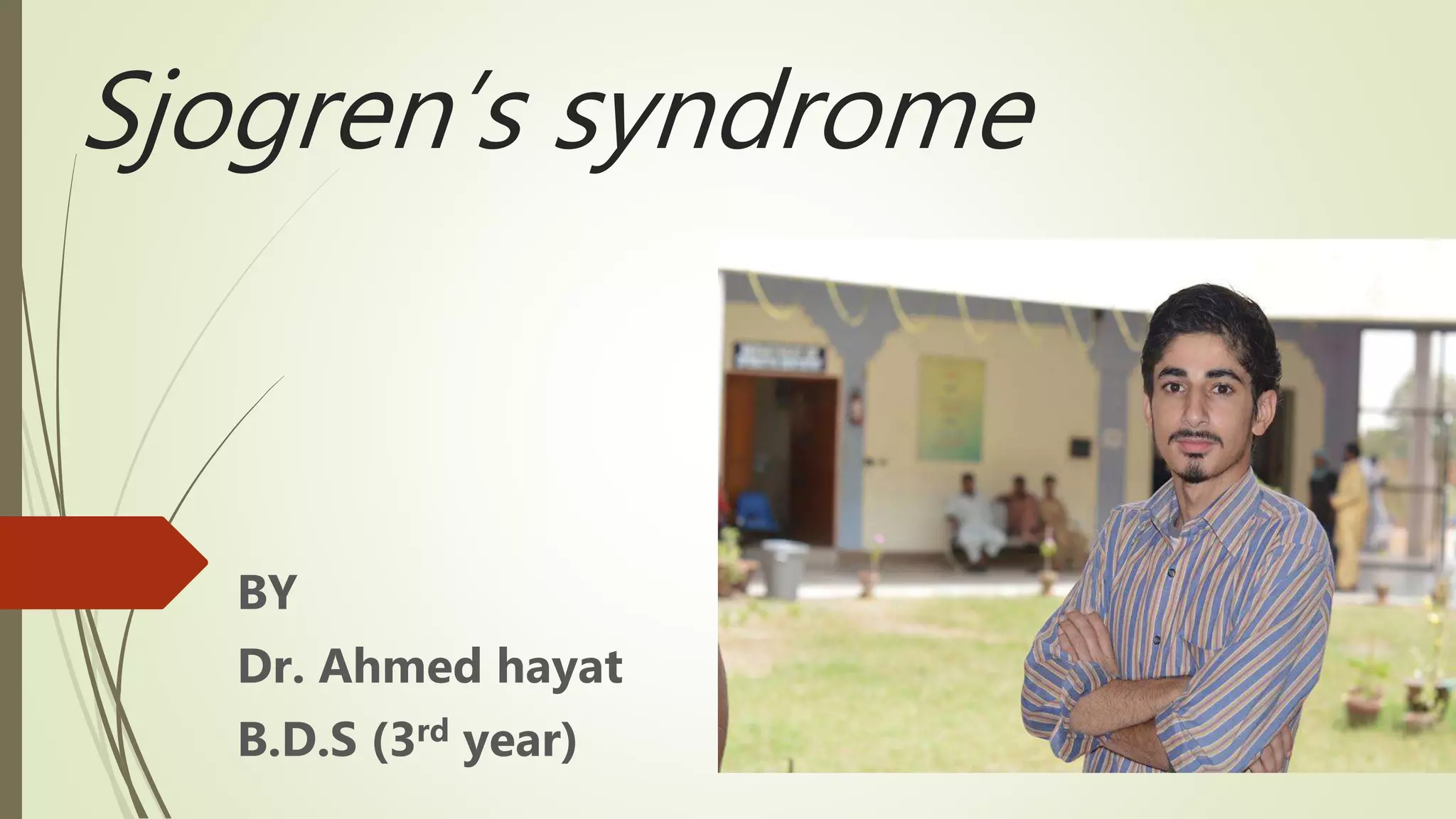 Sjogren’s syndrome | PPTX
