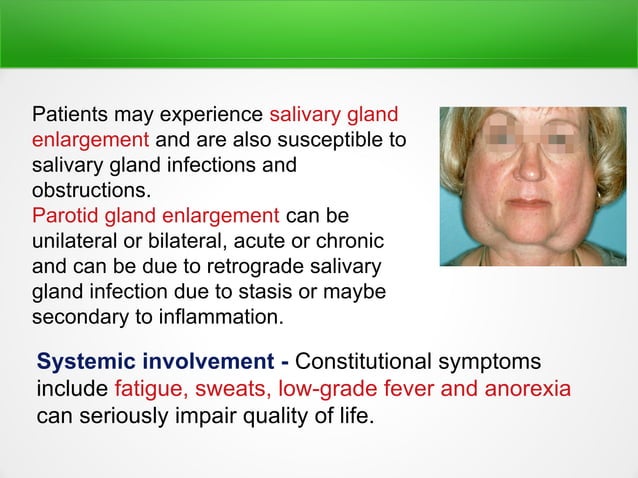 Sjogren's Syndrome | PDF | Ear, Nose and Throat Conditions | Diseases ...