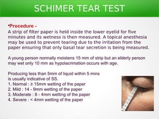 Sjogren's Syndrome | PDF