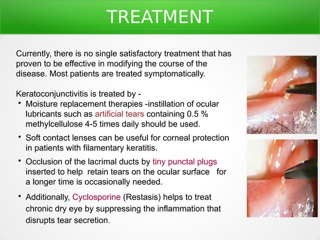 Sjogren's Syndrome | PDF | Ear, Nose and Throat Conditions | Diseases ...