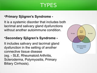 Sjogren's Syndrome | PDF