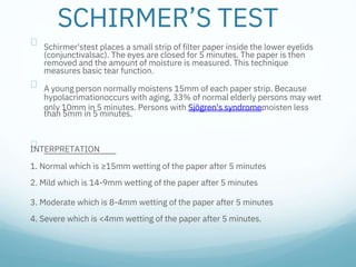 sjogren's syndrome clinical features,diagnosis,management | PPT