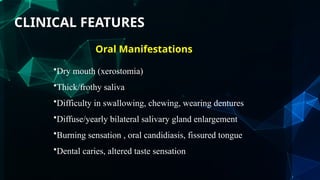 sjogren syndrome salivary glands pathology.pptx