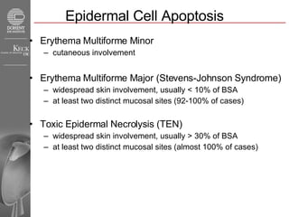 Stevens-Johnson Syndrome | PPT | Eye and Vision Conditions | Diseases ...