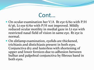Stevens Johnson Syndrome | PPT