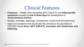 steven johnson syndrome | PPTX