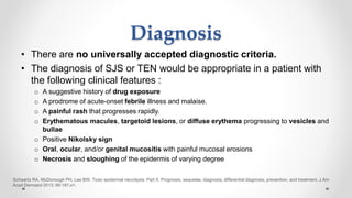 steven johnson syndrome | PPTX