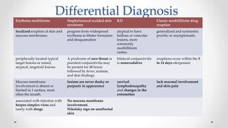 steven johnson syndrome | PPTX
