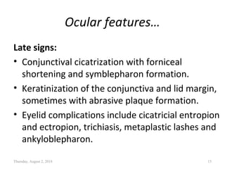 Sjs stevens johnson syndorme Eye Ophthalmology | PPT