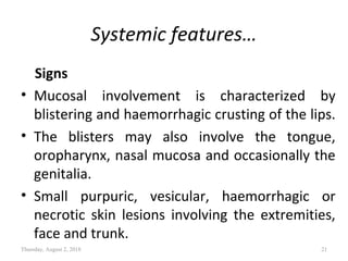 Sjs stevens johnson syndorme Eye Ophthalmology | PPT