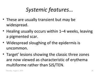 Sjs stevens johnson syndorme Eye Ophthalmology | PPT