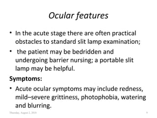 Sjs stevens johnson syndorme Eye Ophthalmology | PPT
