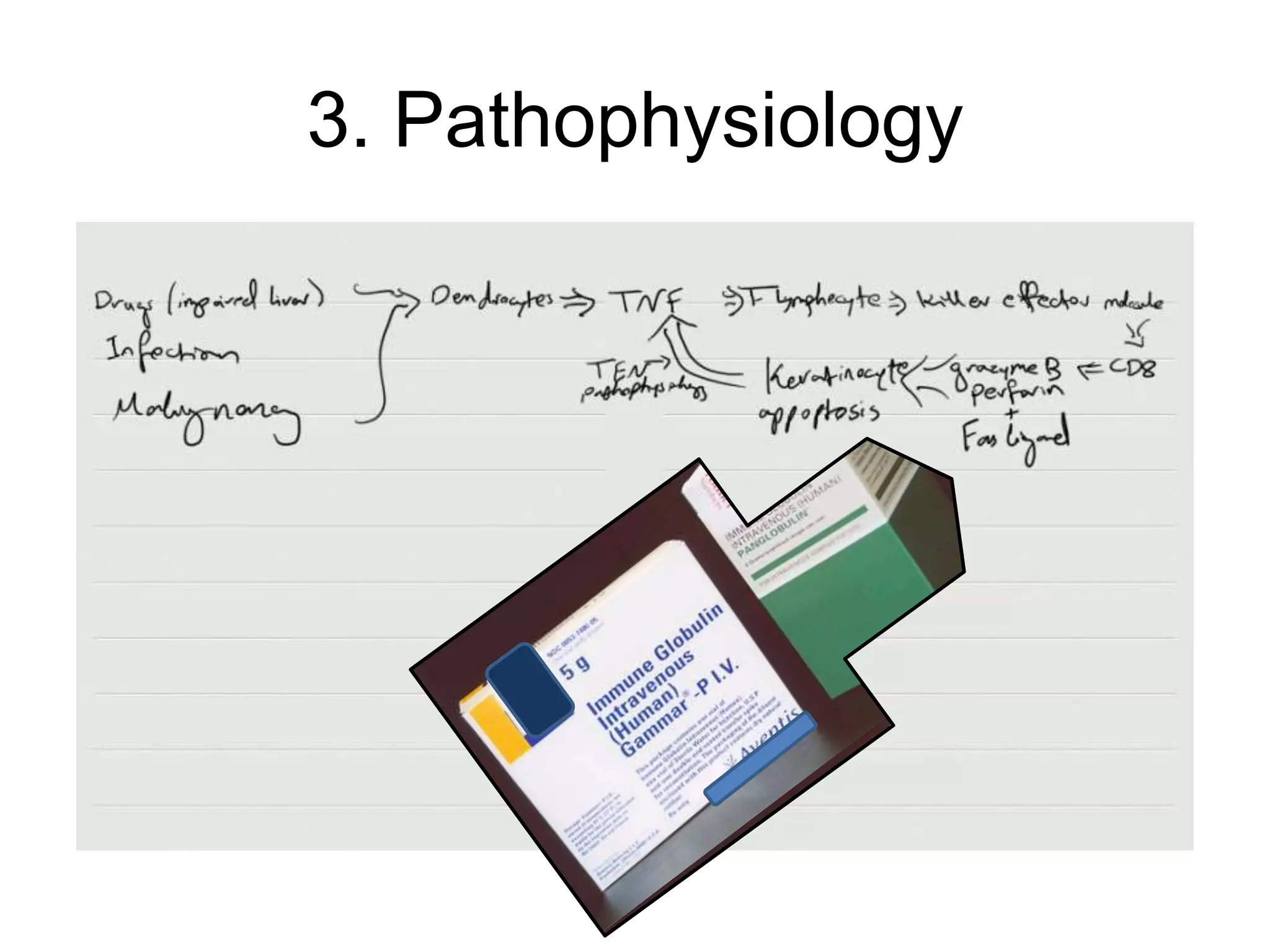 Stevens-Johnson syndrome/ Toxic epidermal necrolysis emergency ...