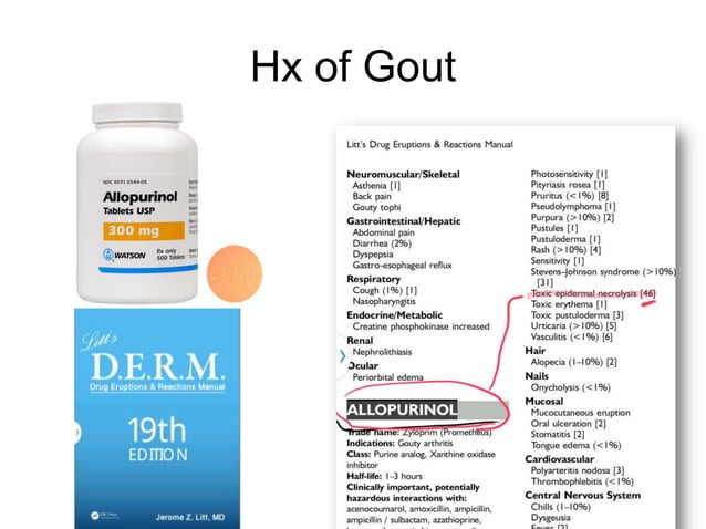 Stevens-Johnson syndrome/ Toxic epidermal necrolysis emergency ...