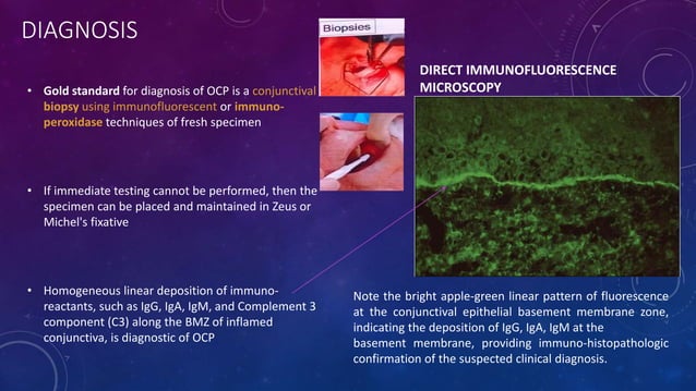 Ocular cicatricial pemphigoid, Stevens-Johnson Syndrome, Toxic ...