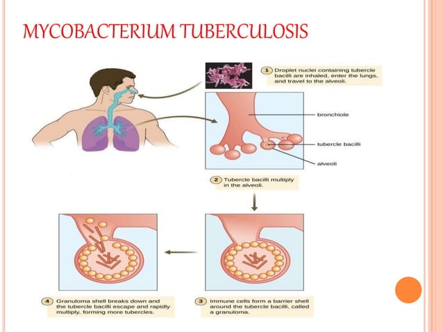 Role of nano drug delivery for tuberculosis treatment. | PPT