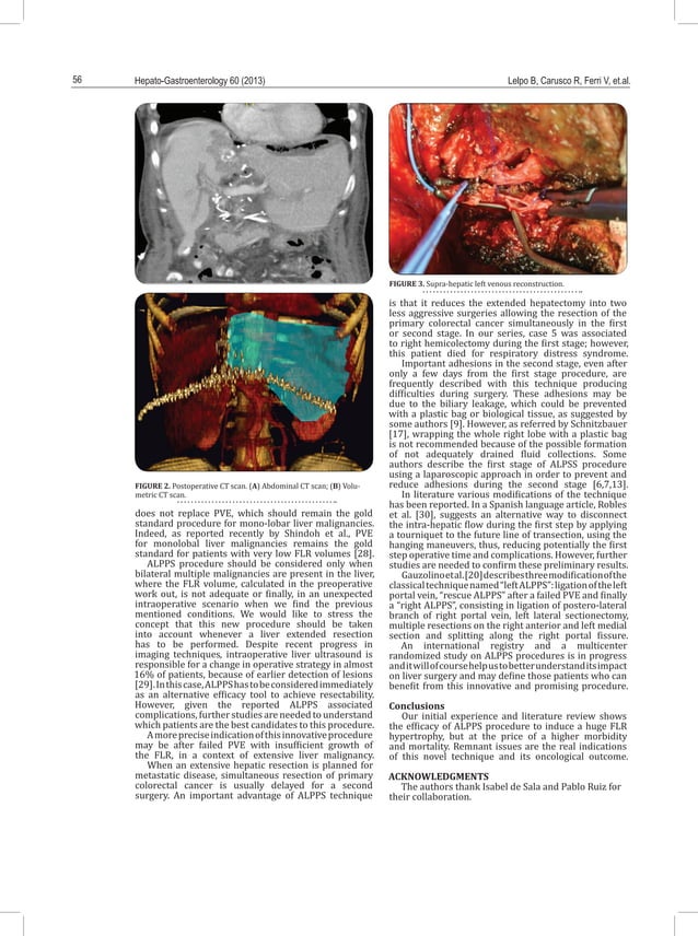 ALPPS_ProcedureOur_Experience_and.pdf