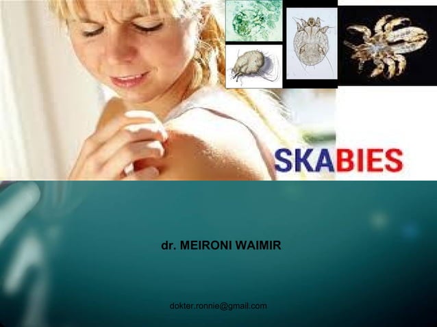 Skabies | PPT