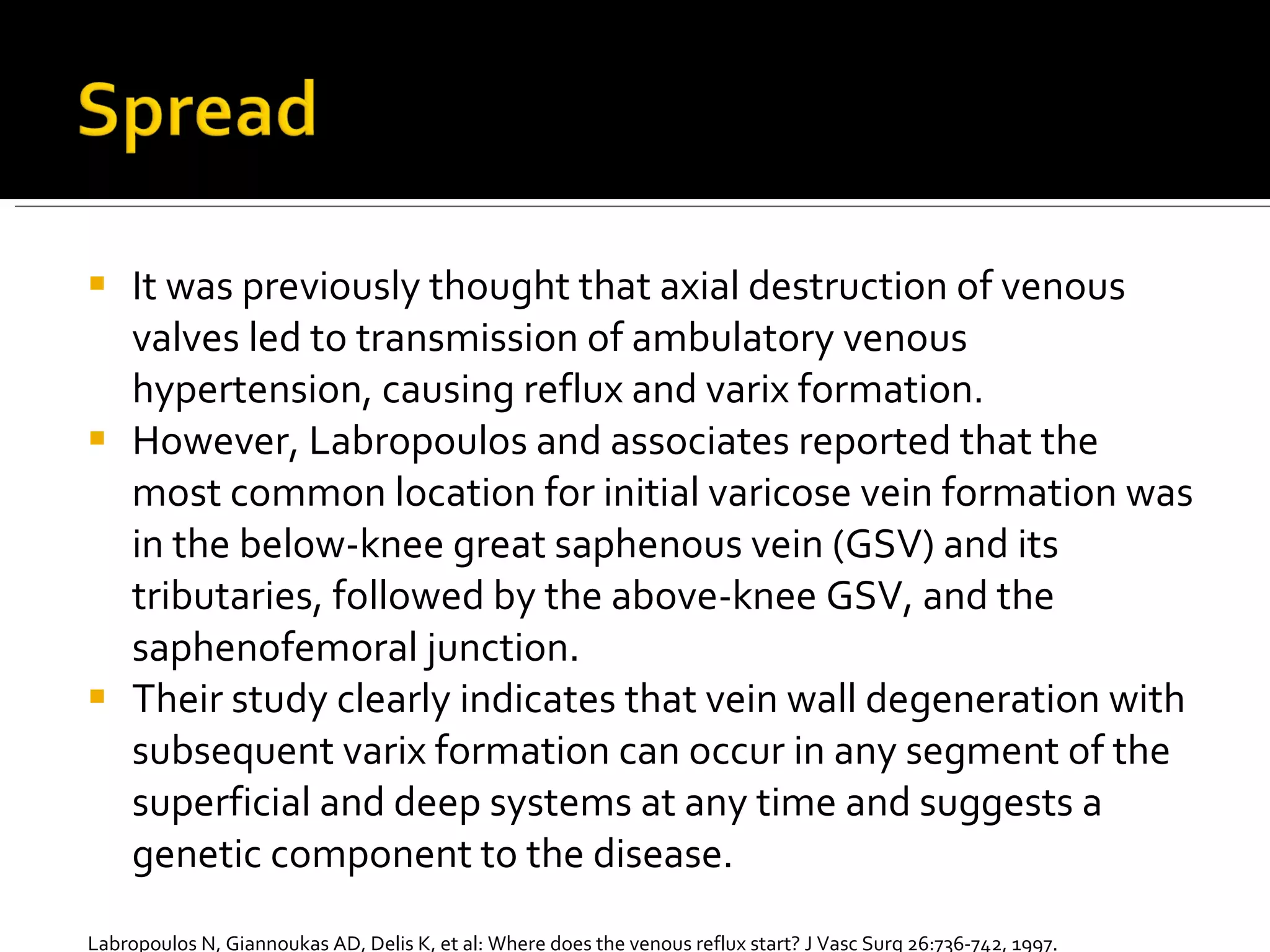Varicose Veins | PPT
