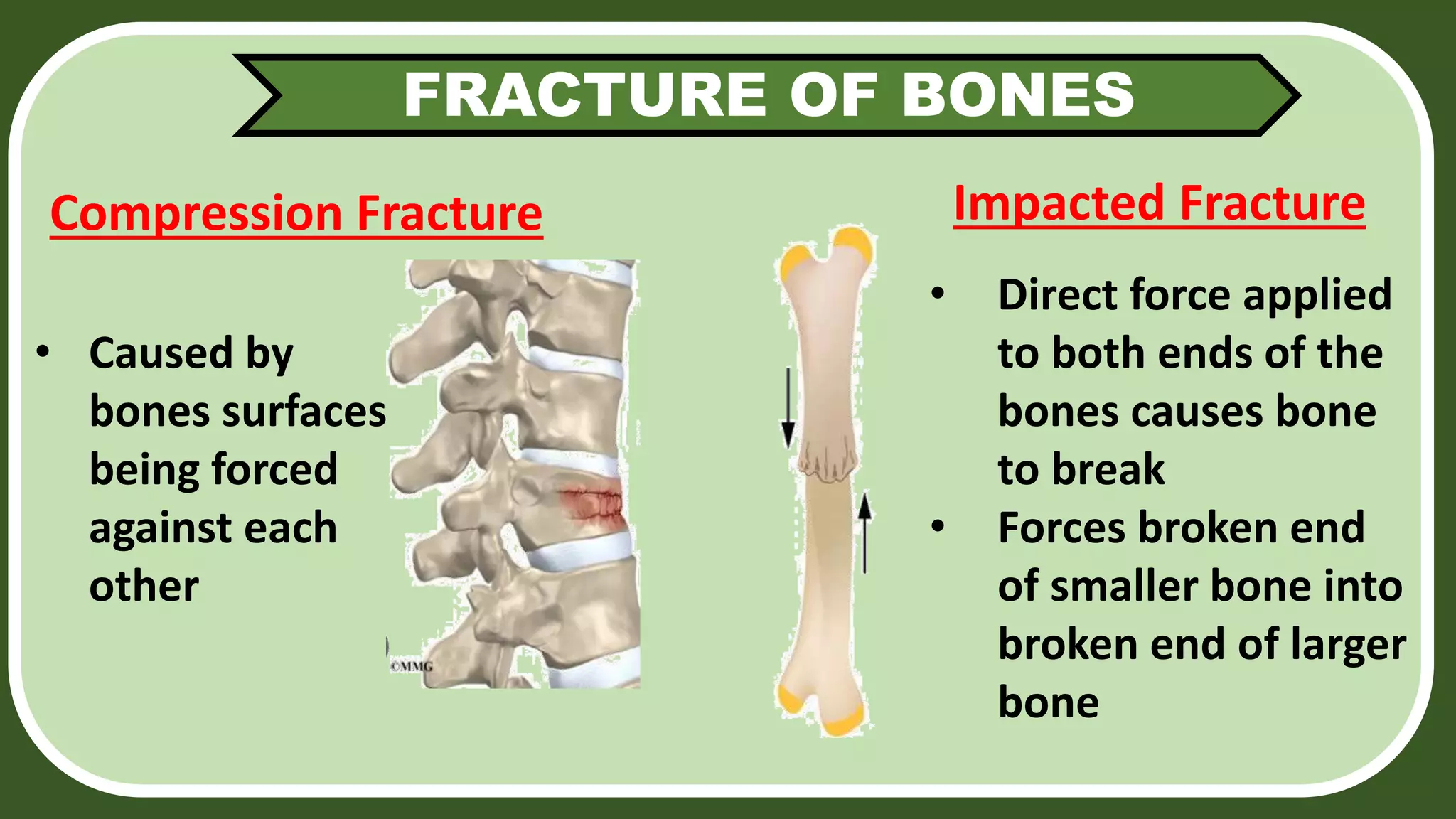 SKELETAL-SYSTEM-1.pptx