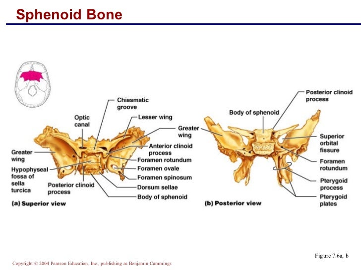 Hypophyseal Fossa Of Sphenoid Bone This Image Shows The Location And