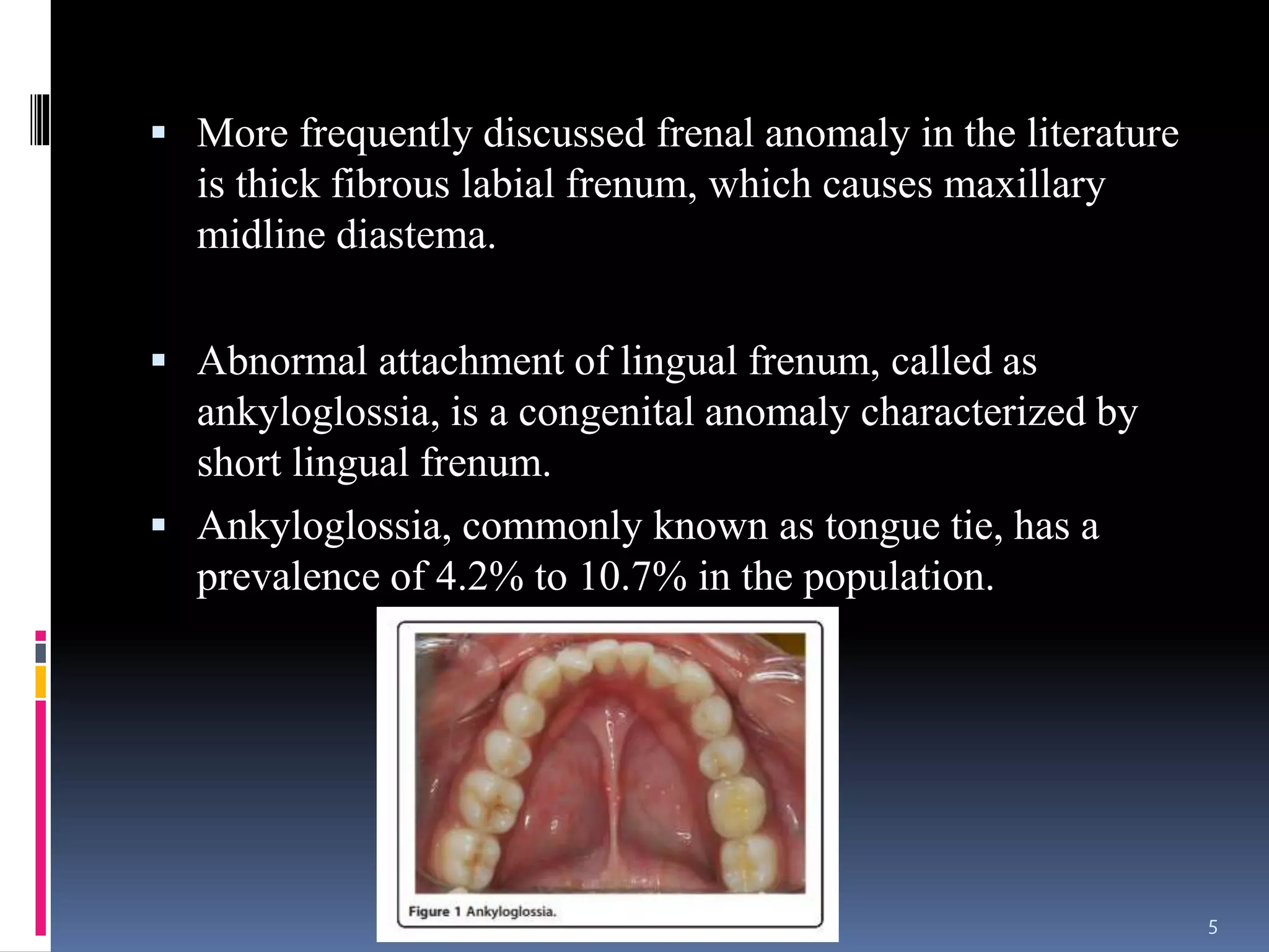 skeletal and dental characteristics of ankyloglossia | PPTX