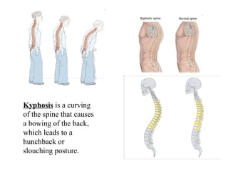 Skeletal And Muscle Ppt | PPT