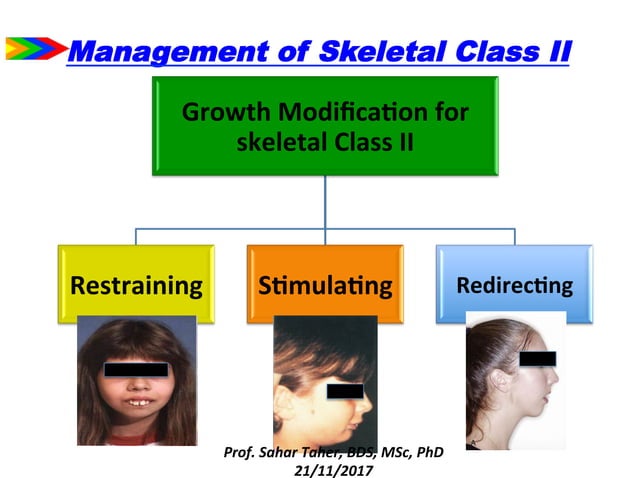 Skeletal Class II - Mixed Dentition, By Prof. Sahar Taher | PDF ...