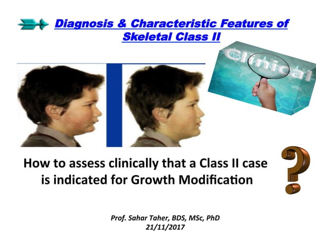 Skeletal Class II - Mixed Dentition, By Prof. Sahar Taher | PDF ...