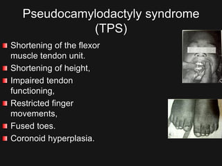 Skeletal deformities of lower third | PDF