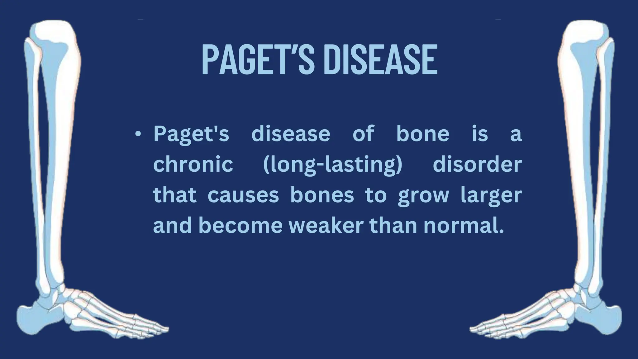 Skeletal System Diseases.pptx (For educational purposes only) | PPT