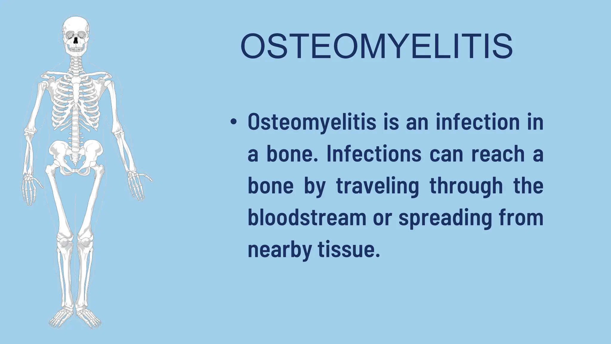 Skeletal System Diseases.pptx (For educational purposes only) | PPT
