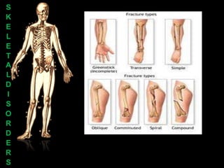 Skeletal disorders | PPTX