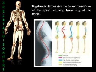 Skeletal disorders | PPTX