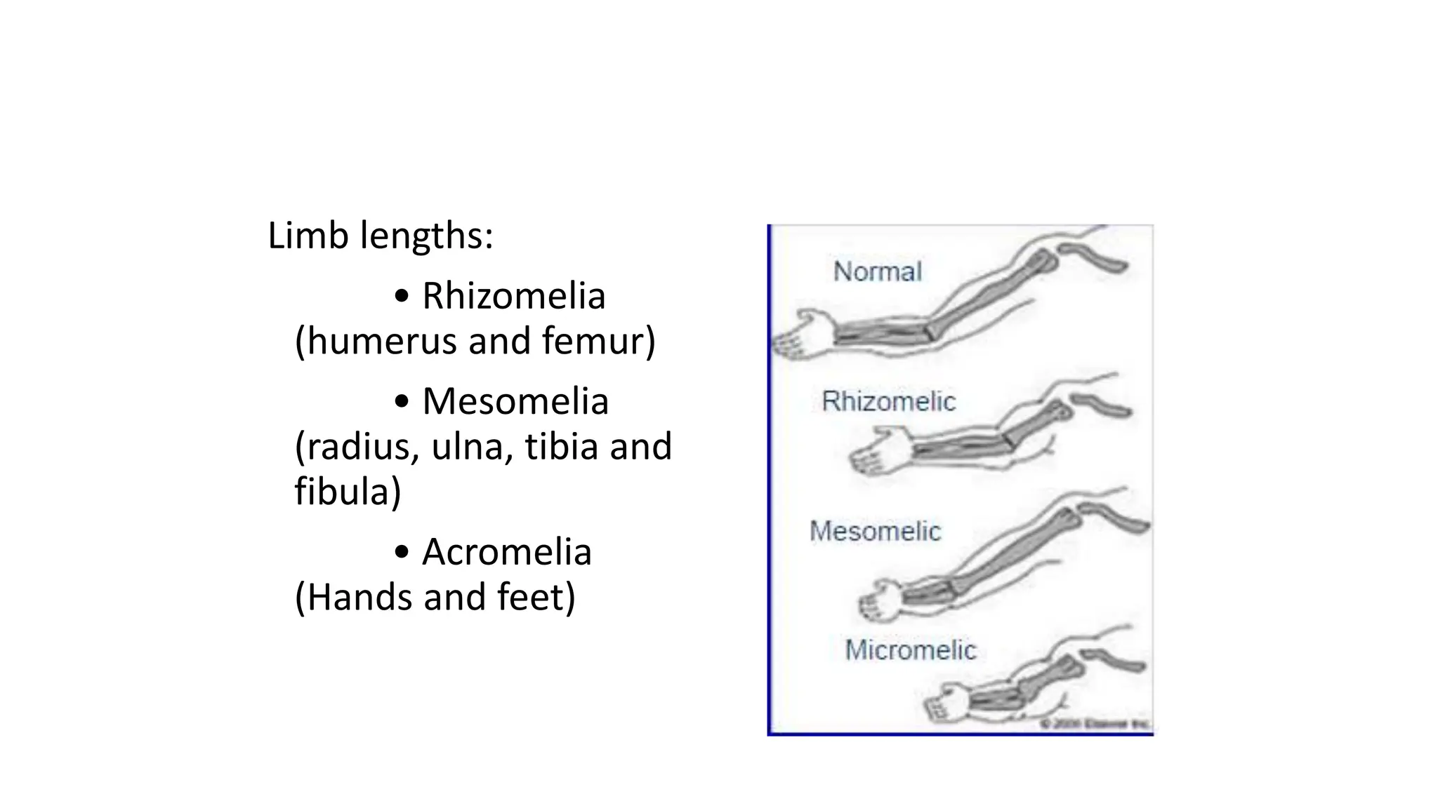 SKELETAL DYSPLASIAs ( 2024).pptx imaging | PPTX