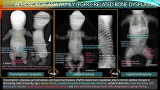 Imaging in skeletal dysplasia based on families | PPTX