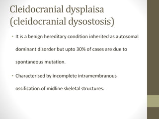 Skeletal dysplasias | PPTX