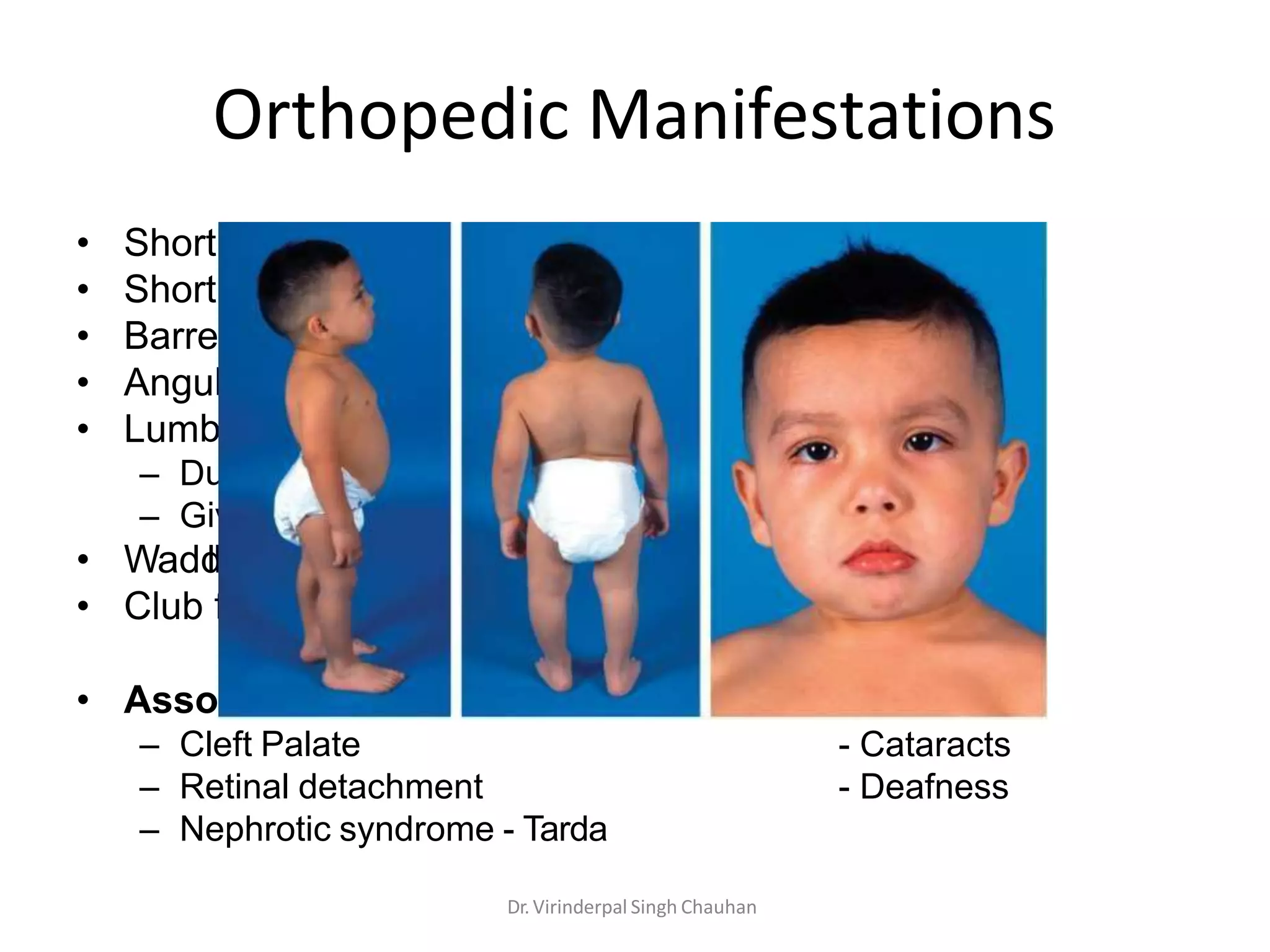 skeletaldysplasias-170827143031.pptx
