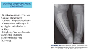 Skeletal dysplasia musculoskeletal radiology | PPTX
