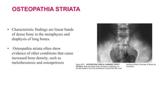 Skeletal dysplasia musculoskeletal radiology | PPTX