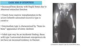 Skeletal dysplasia musculoskeletal radiology | PPTX
