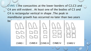 Skeletal maturation evaluation using cervical vertebrae | PPTX