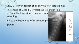 Skeletal maturation evaluation using cervical vertebrae | PPTX