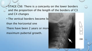 Skeletal maturation evaluation using cervical vertebrae | PPTX