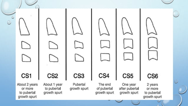 Skeletal maturation evaluation using cervical vertebrae