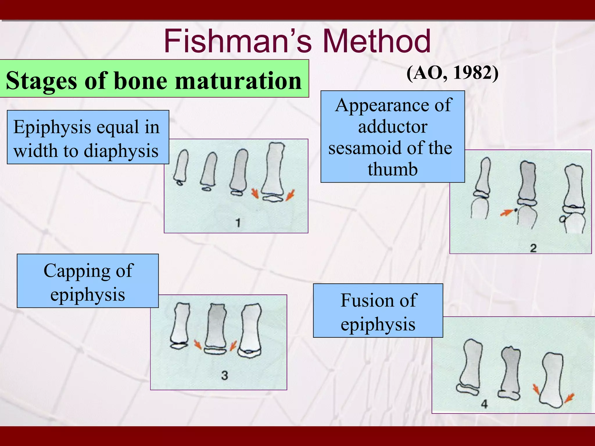 Skeletal maturity indicators | PPT