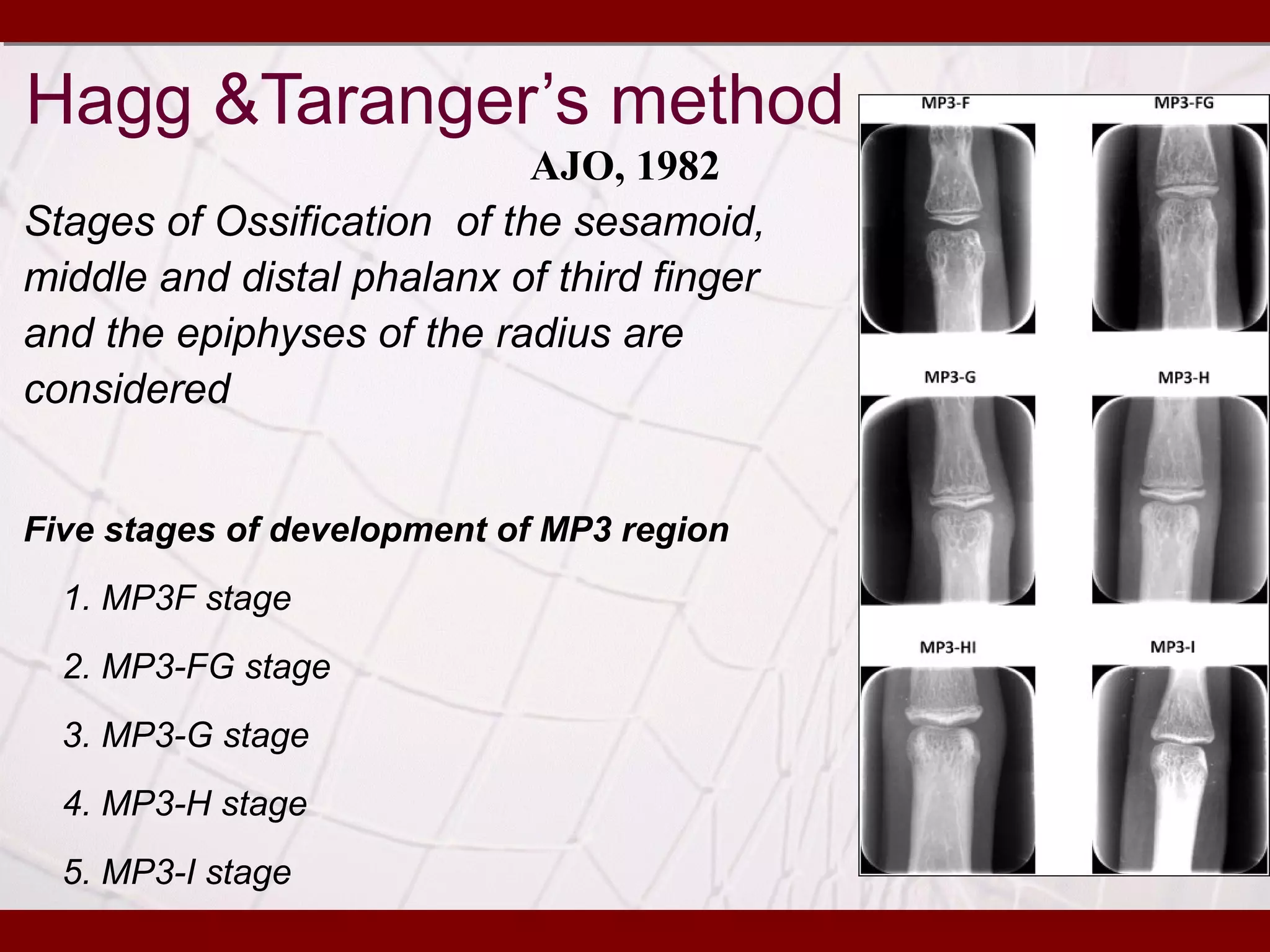 Skeletal maturity indicators | PPT