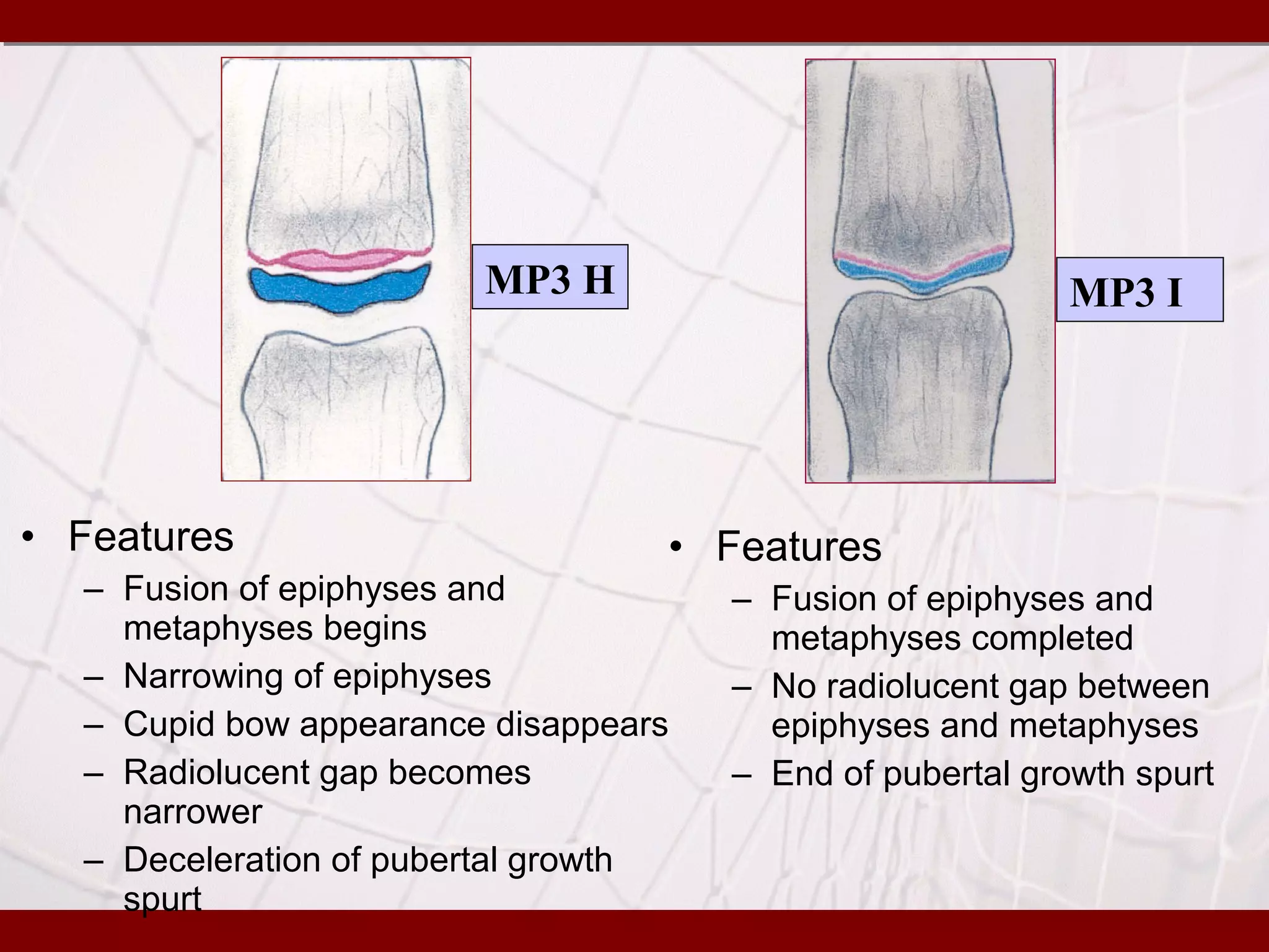 Skeletal maturity indicators | PPT