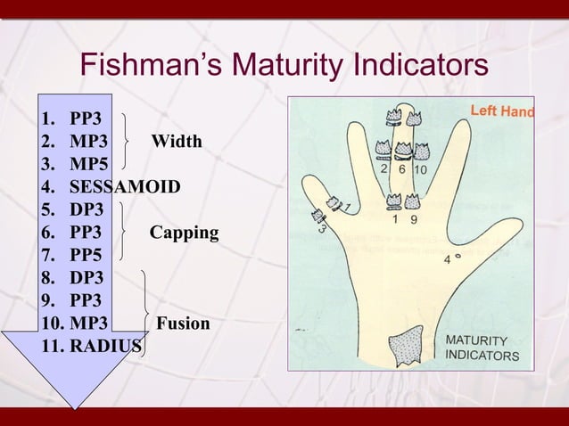 Skeletal maturity indicators | PPT