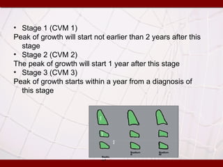 Skeletal maturity indicators | PPT